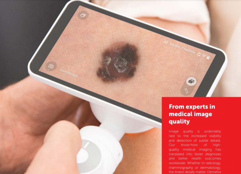 Barco announces the interface of Demetra digital skin imaging system ...