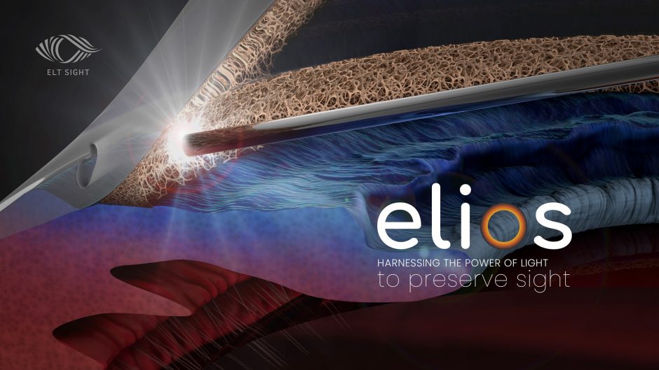 Elios Vision | EuropaWire