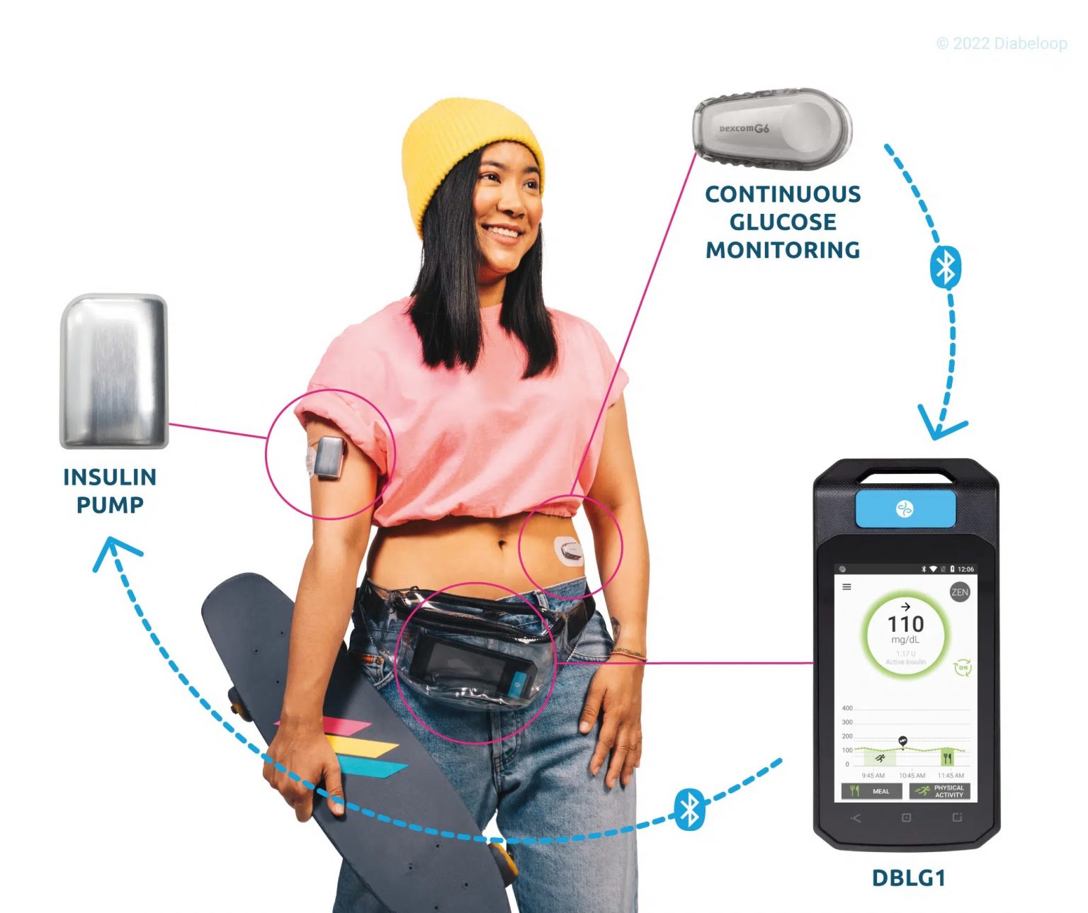 Diabeloop, a key player in therapeutic AI applied to insulin delivery ...
