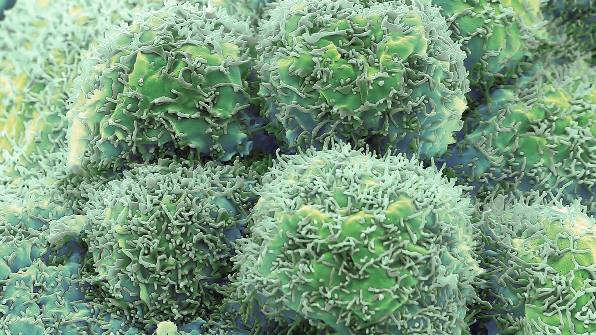 Cancer Treatment Advances: FDA Recognizes Breakthrough Potential of ...